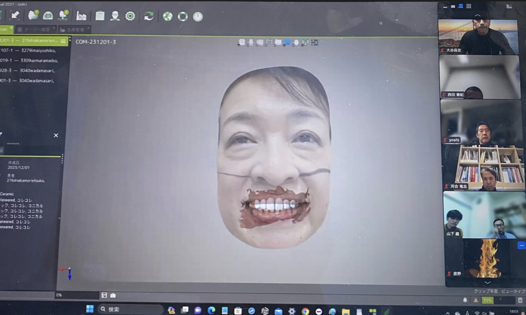 第3回CID Clubなんでも症例検討会報告 | インプラントによる治療の専門的情報サイト「CID club」