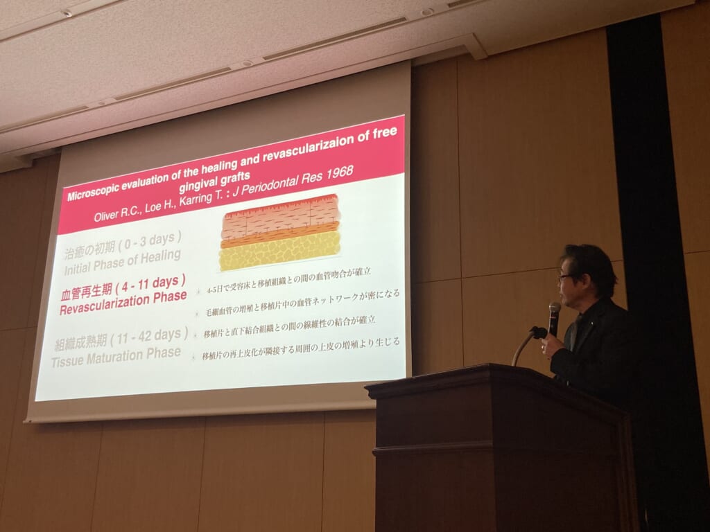 第38回CID Club セミナー 開催報告 | インプラントによる治療の専門的情報サイト「CID club」